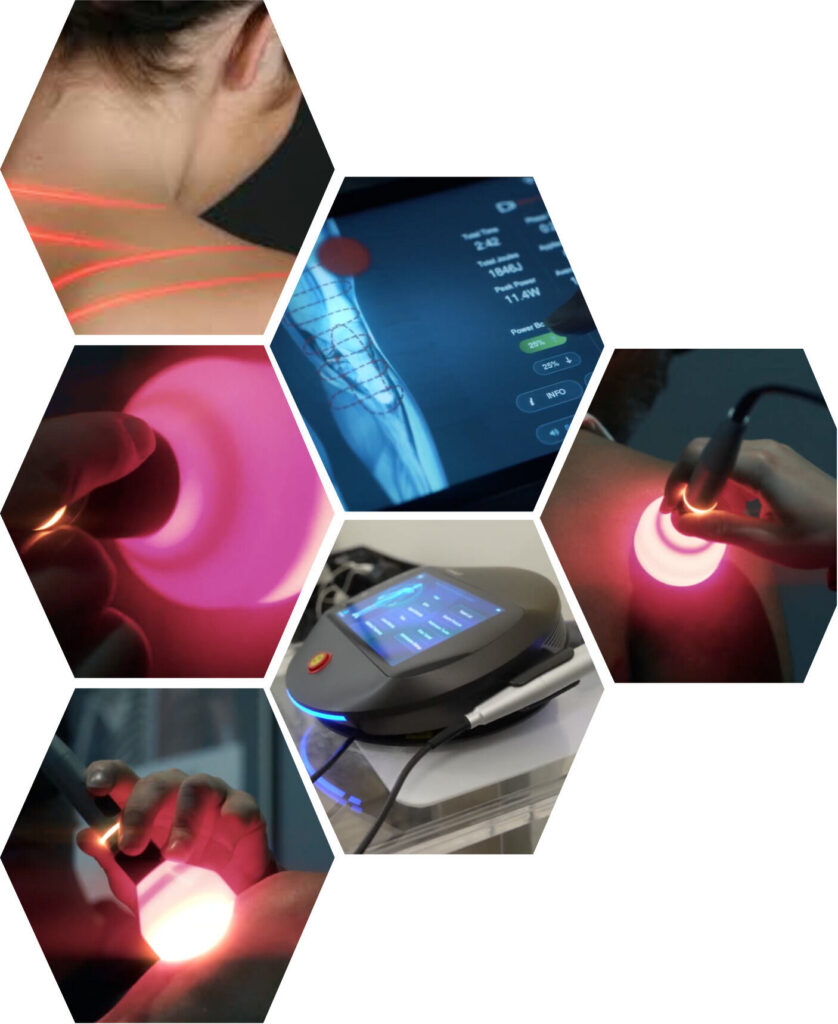 Class IV Laser Therapy - Fitness Therapy, PT, Injuries, Pain, Weight ...