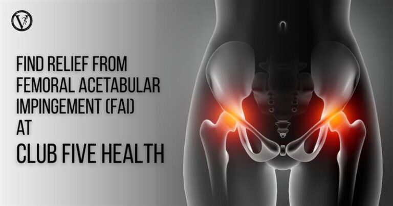 Femoral Acetabular Impingement (FAI) | Club Five Health